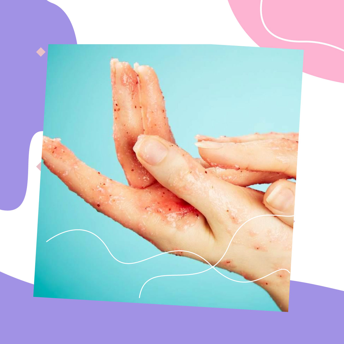 5 mascarillas naturales para lucir manos suaves. ¿Te animas a probarlas ...